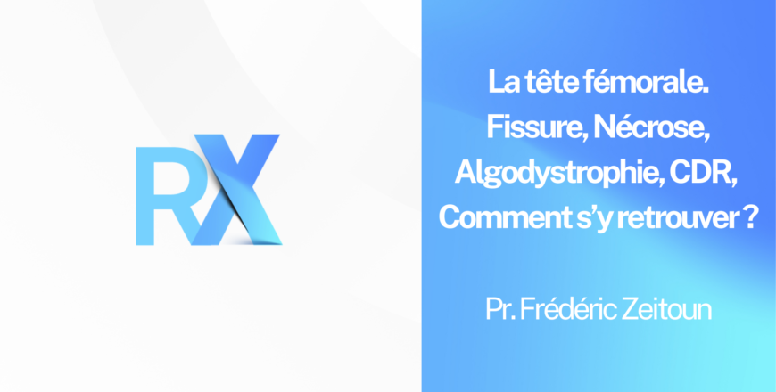 La tête fémorale. Fissure, Nécrose, Algodystrophie, CDR, comment s’y ...